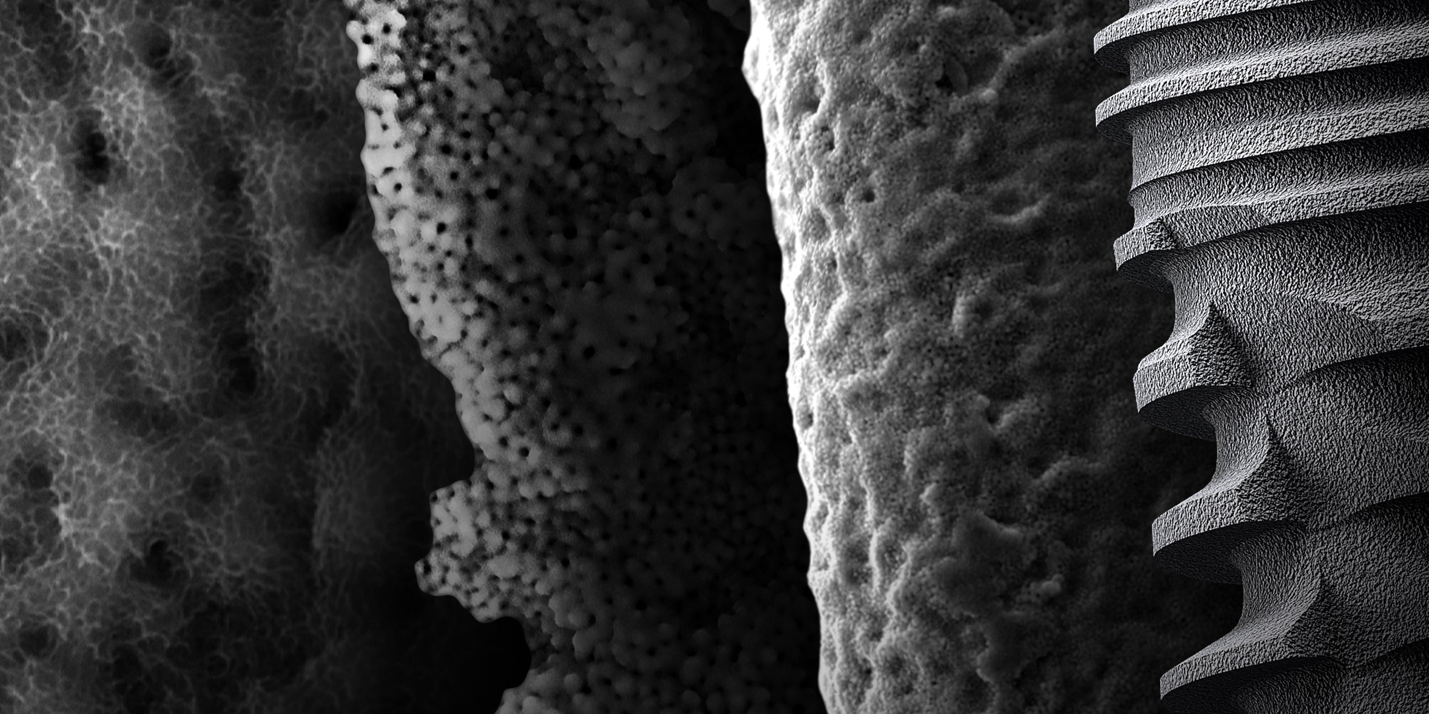 Genesis Active Conical Implant System – Keystone Dental Group