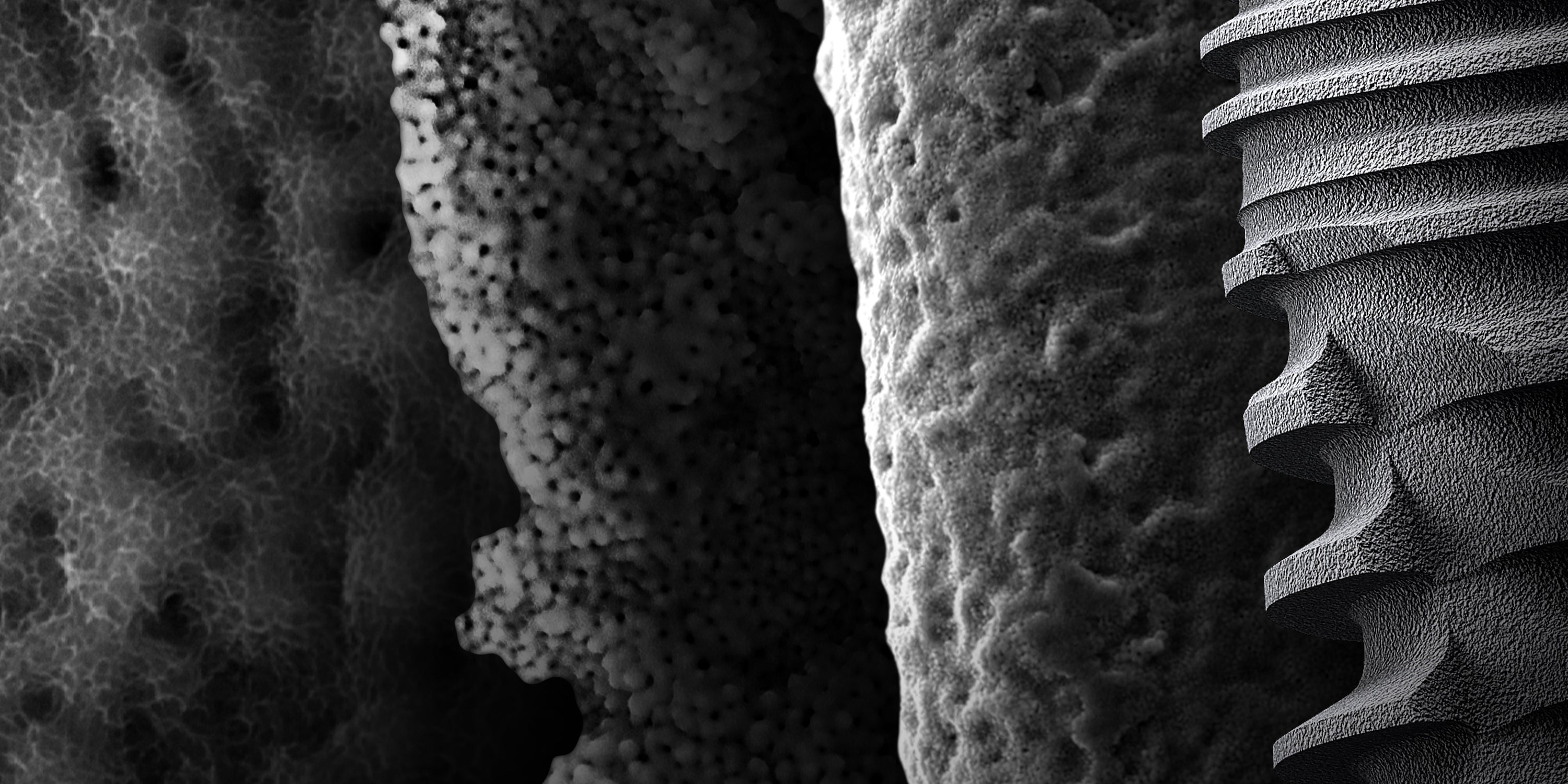 Genesis Active Conical Implant System – Keystone Dental Group